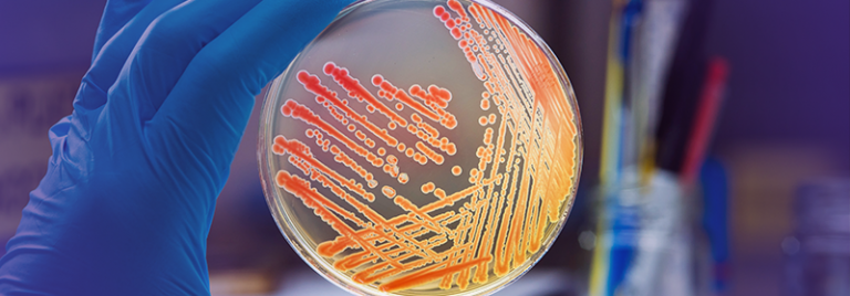 What Are “Logs,” and Why Do They Matter in Preventing Infections ...